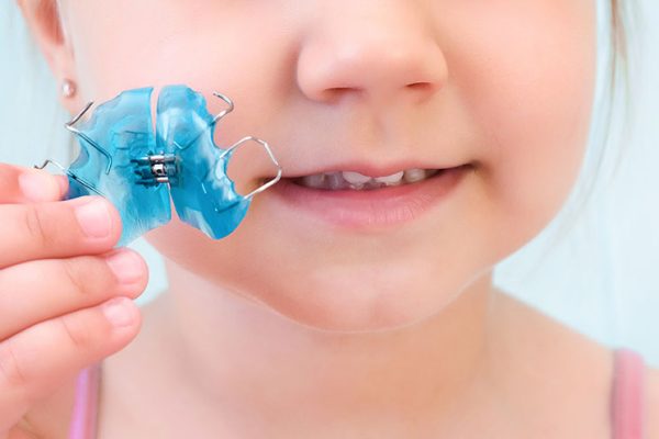 Early Interceptive Orthodontics for Children – Aurora Orthodontics